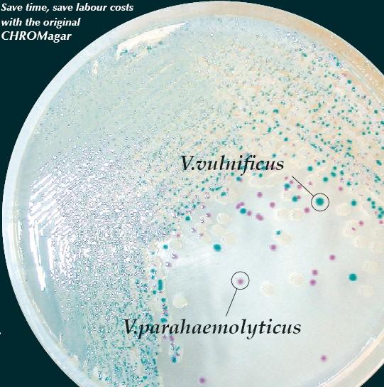 Chrom Agar Vibrio | Asan Pharmaceutical Co Ltd